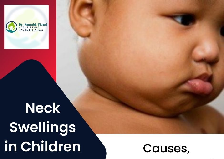 Neck Swelling in Children Causes & Treatment | Dr. Saurabh Tiwari