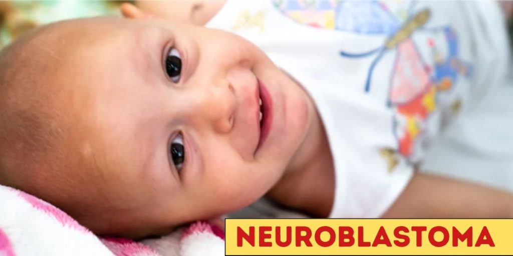 Neuroblastoma – Causes, Symptoms, Diagnosis & Treatment - Dr. Saurabh ...