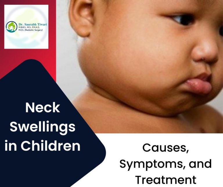 Neck Swelling in Children Causes & Treatment | Dr. Saurabh Tiwari