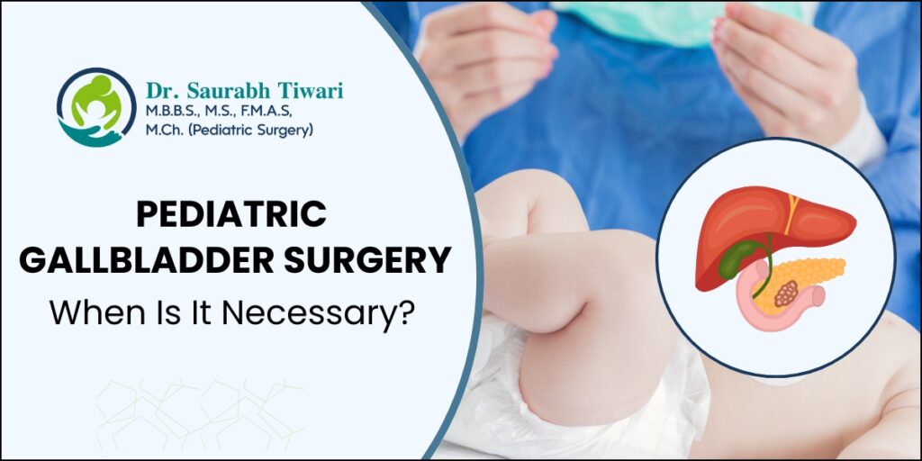 Pediatric Gallbladder Surgery: When Is It Necessary? - Dr. Saurabh Tiwari